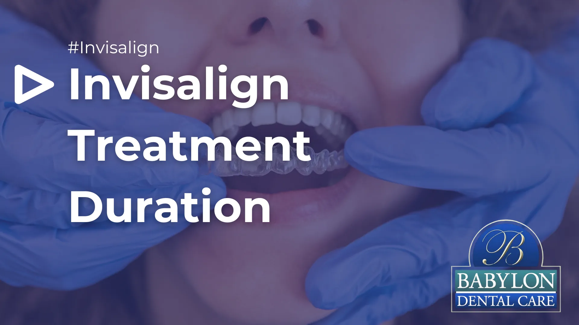 How Long Do You Wear Invisalign?