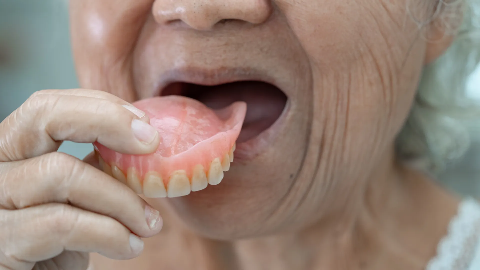 Essential Tips for Proper Denture Maintenance